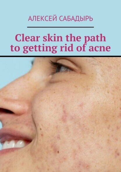 Clear skin the path to getting rid of acne [Цифровая книга]
