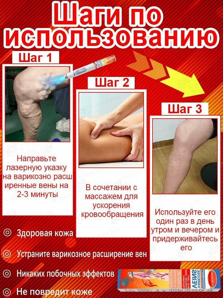 Лечение варикозного расширения вен лазерной указкой, снятие отечности ног, тяжести и отека, тромбоза, улучшение микроциркуляции, эффективное лечение сосудистых звездочек.1 шт.