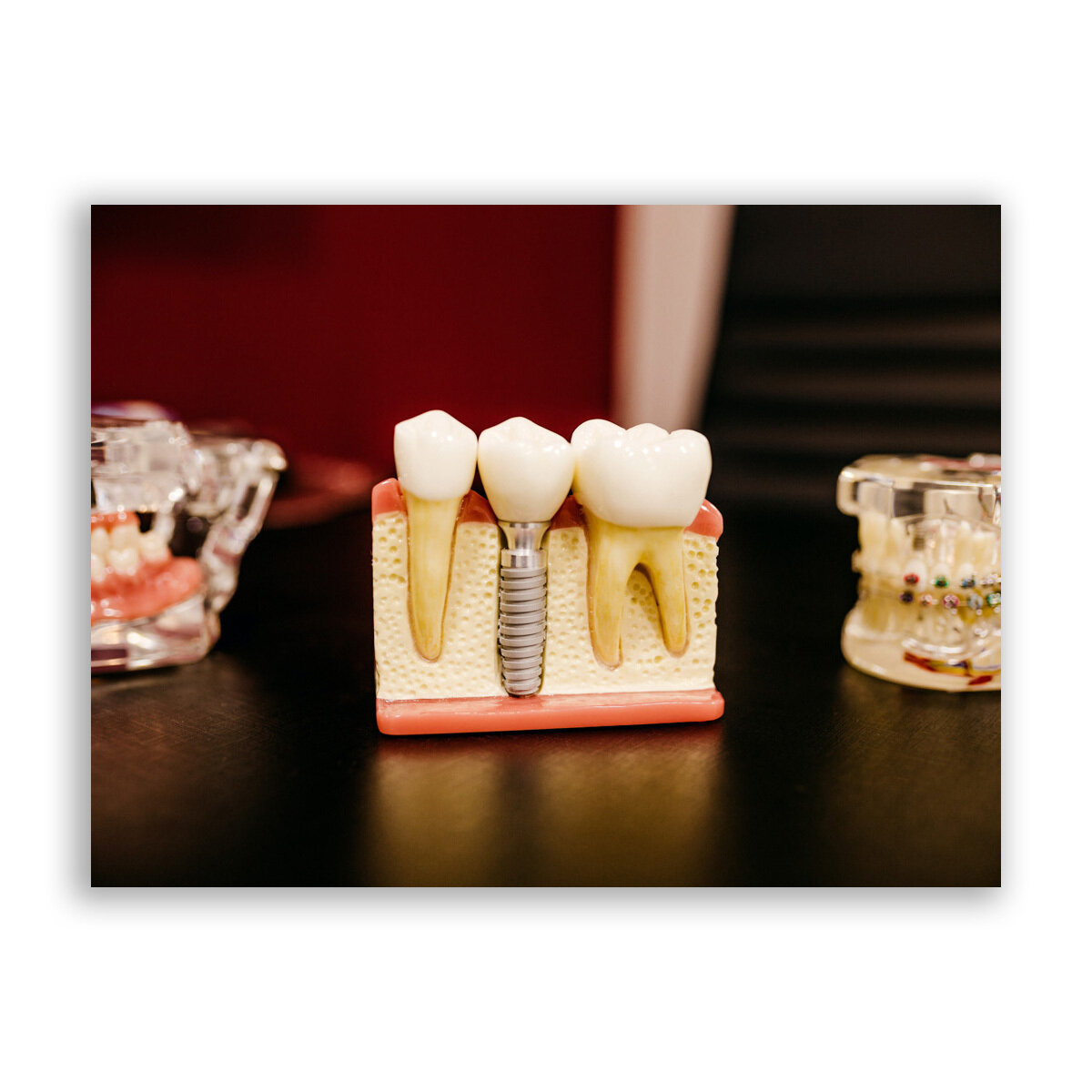 Постер, плакат на бумаге / Для стоматологии / Размер 40 x 53 см