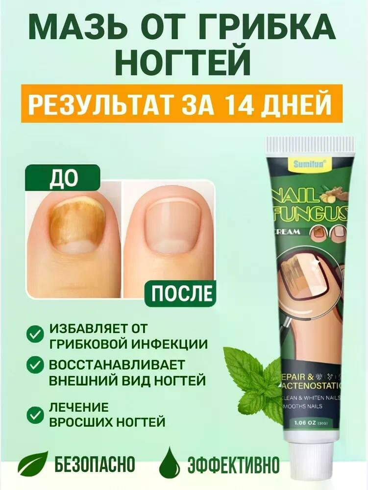 Мазь от грибка ногтей , Средство грибка на ногах эффективное