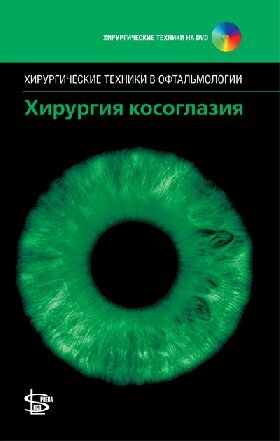 Джон Д. Феррис, Питер И. Дж. Дейвис "Хирургия косоглазия + CD (Серия "Хирургические техники в офтальмологии")"