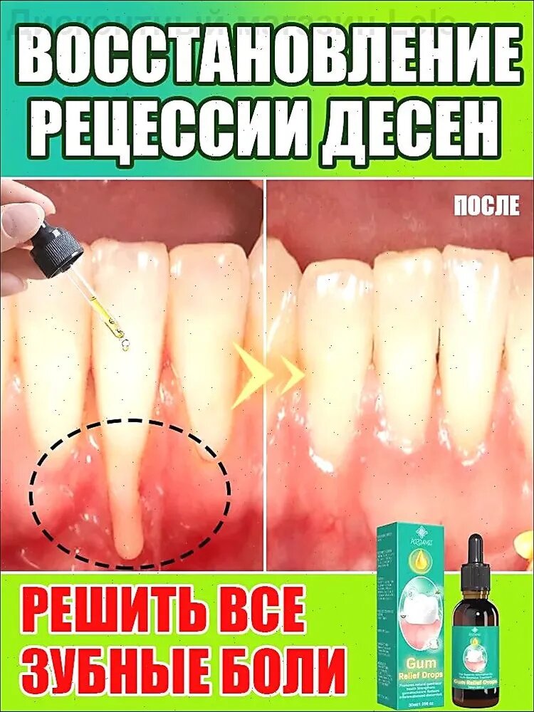 Масло для гигиены полости рта/для чувствительных десен/ пародонтоза, Быстро лечит опухшие и отступающие десны, пародонтит, снимает чувствительность десен и поддерживает гигиену полости рта 30 мл