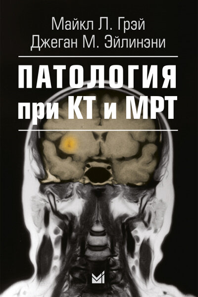 Патология при КТ и МРТ