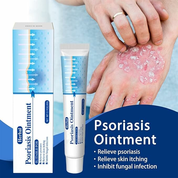 Успокаивающая мазь от псориаза, новая версия натуральной китайской травяной успокаивающей мази, безопасной и эффективной