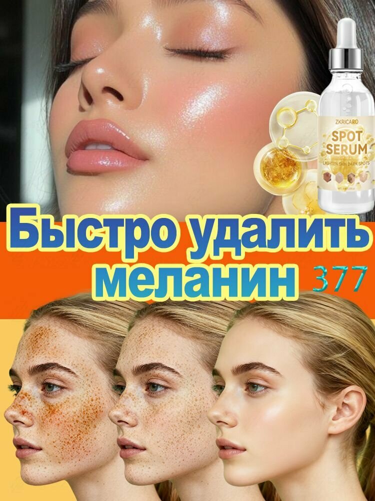 Эссенция для отбеливания и устранения веснушек. Борется с пигментацией, избавляет от меланомы, избавляет от веснушек, избавляет от пигментных пятен, выравнивает тон кожи, антивозрастное средство, 30 мл