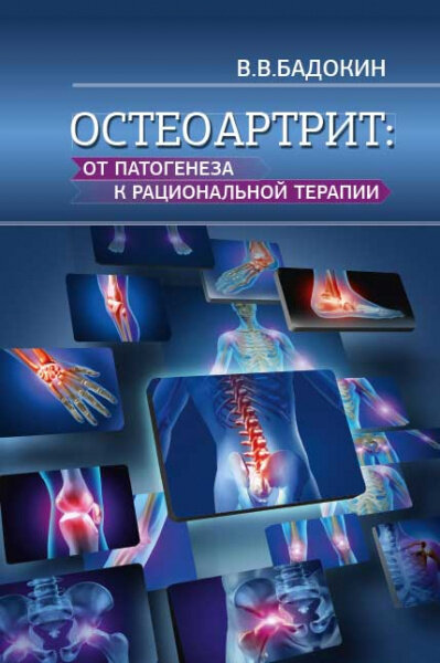 Остеоартрит: от патогенеза к рациональной терапии