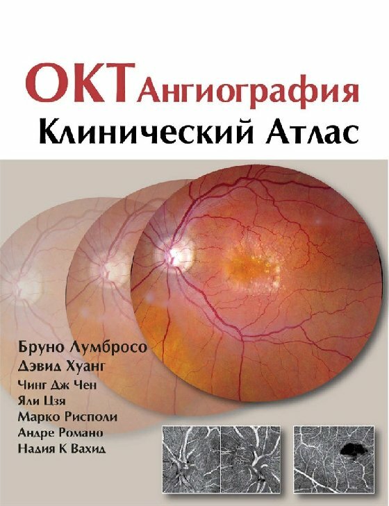 Бруно Лумбросо, Дэвид Хуанг, Чинг Дж. Чен "ОКТ-ангиография. Клинический атлас"