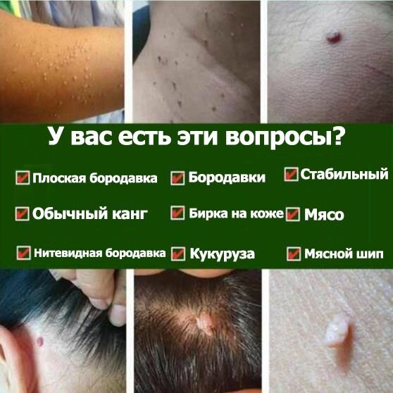 Крем от бородавок, Крем-гель от бородавок и папиллом, 20 г