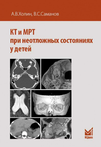 КТ и МРТ при неотложных состояниях у детей
