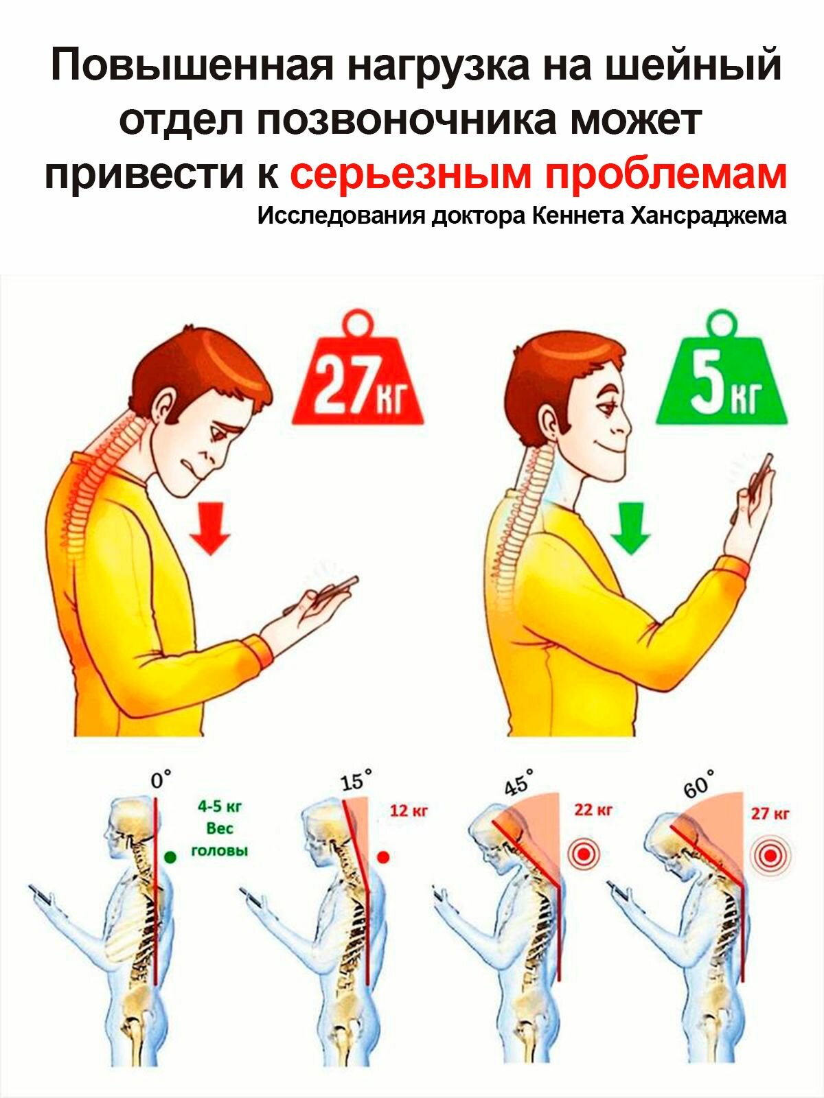 Тренажёр для шеи — фото 1