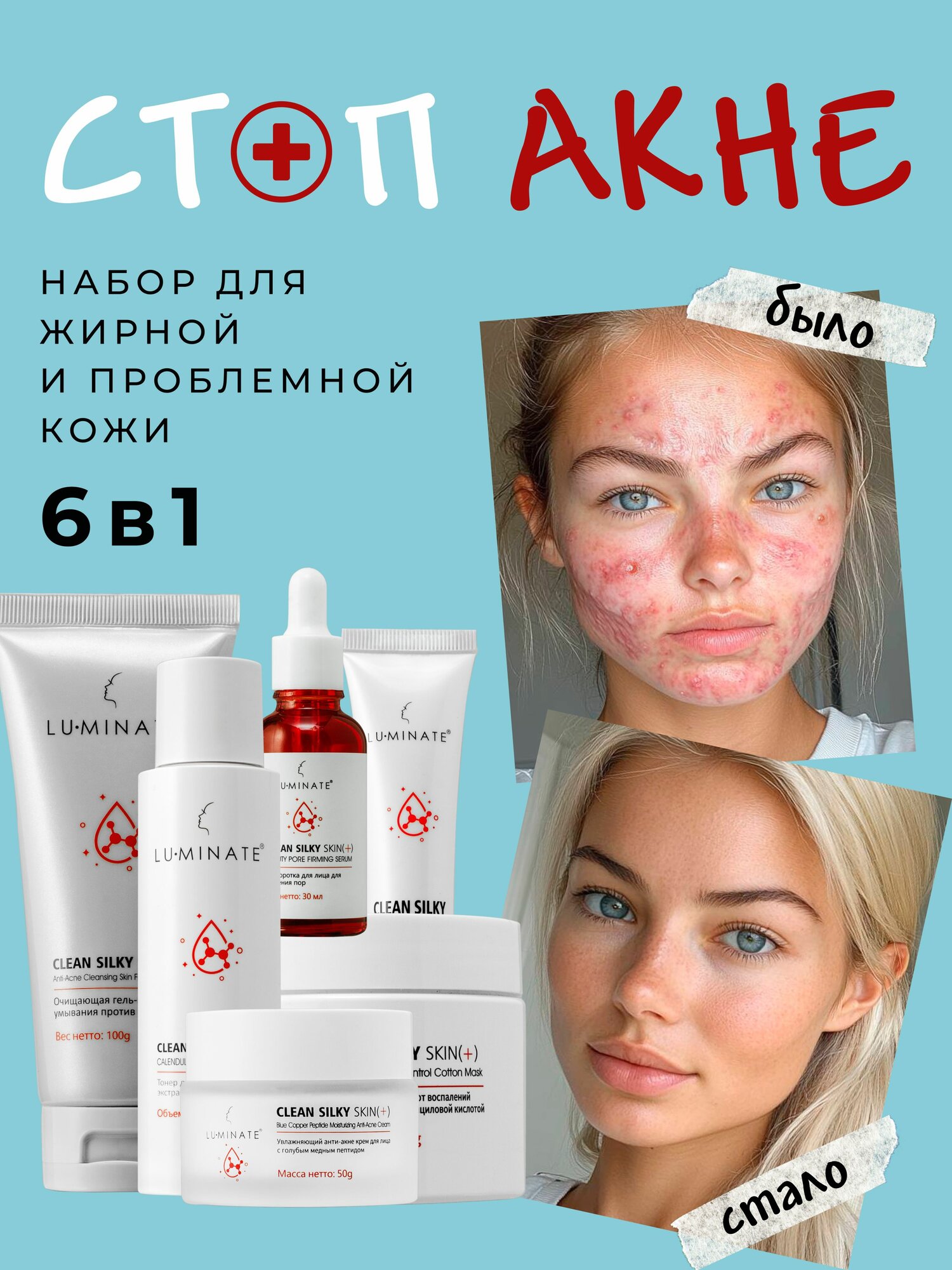 LU MINATE Набор косметики от прыщей анти акне с салициловой кислотой, ниацинамидом, гиалуроновой кислотой и экстрактом растений, 6в1