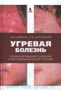 Угревая болезнь. Комбинированная лазерная и фотодинамическая терапия : руководство для врача