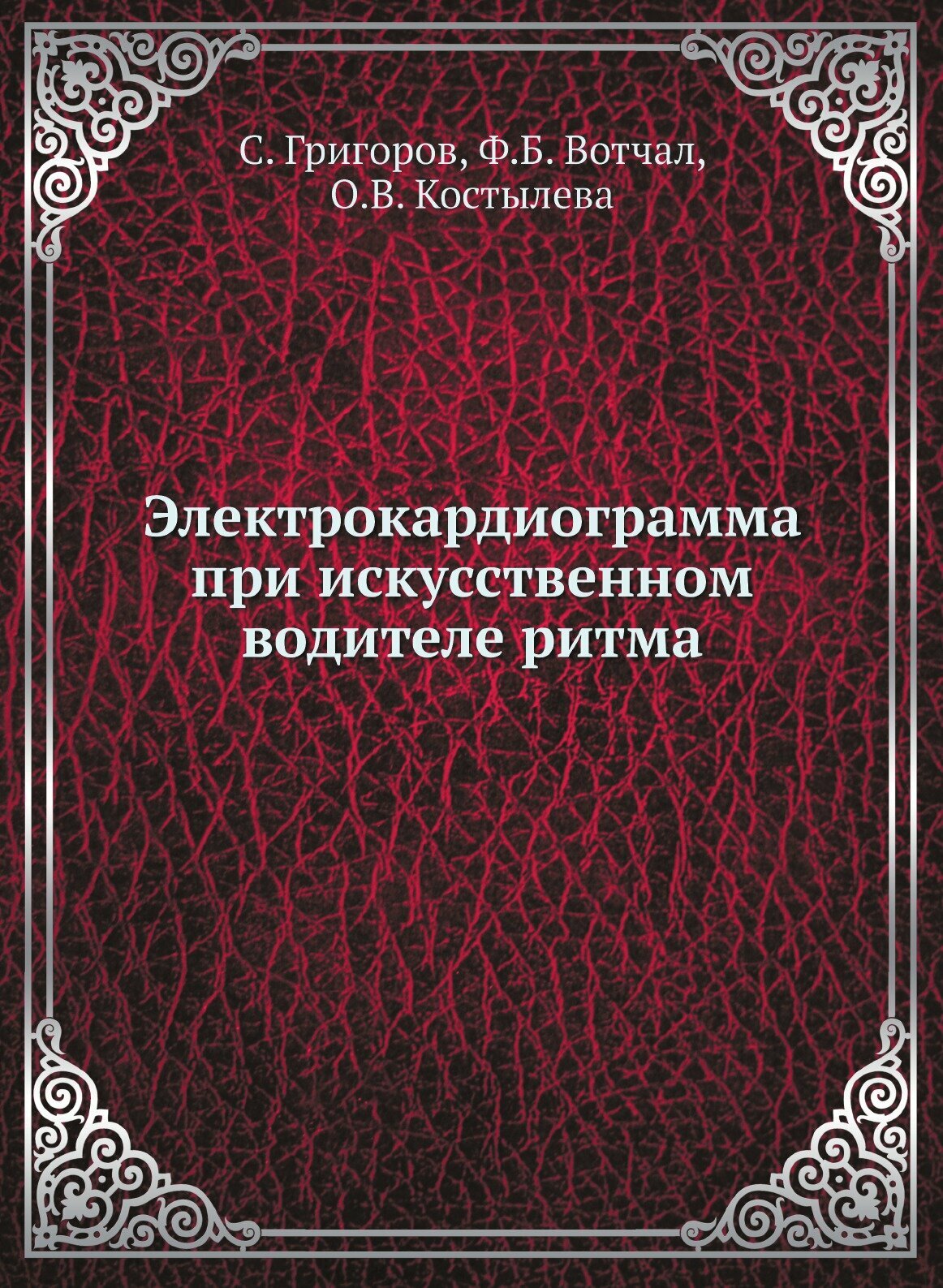 Электрокардиограмма при искусственном водителе ритма