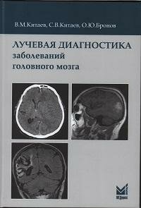 Книга "Лучевая диагностика заболеваний головного мозга"