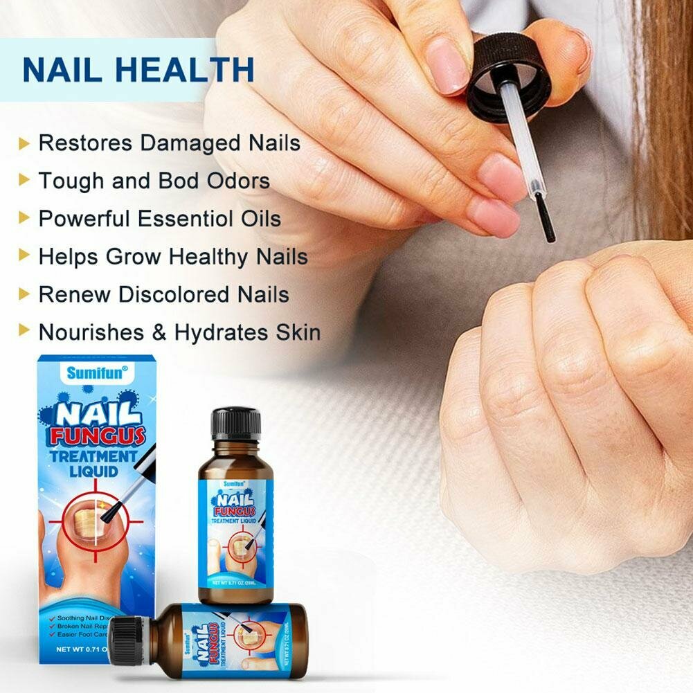 Средство от грибка ногтей на ногах; Противогрибковая мазь на основе натуральных компонентов