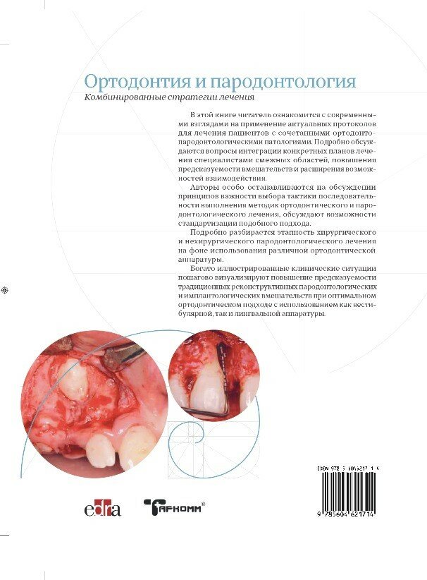 Ортодонтия и пародонтология. Комбинированные стратегии лечения