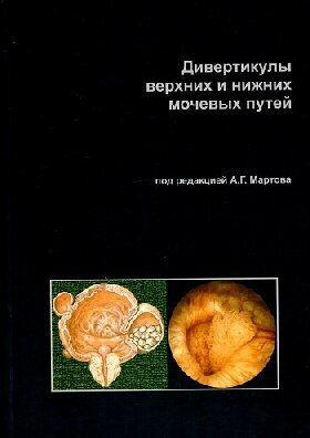 Мартов А. Г. "Дивертикулы верхних и нижних мочевых путей"