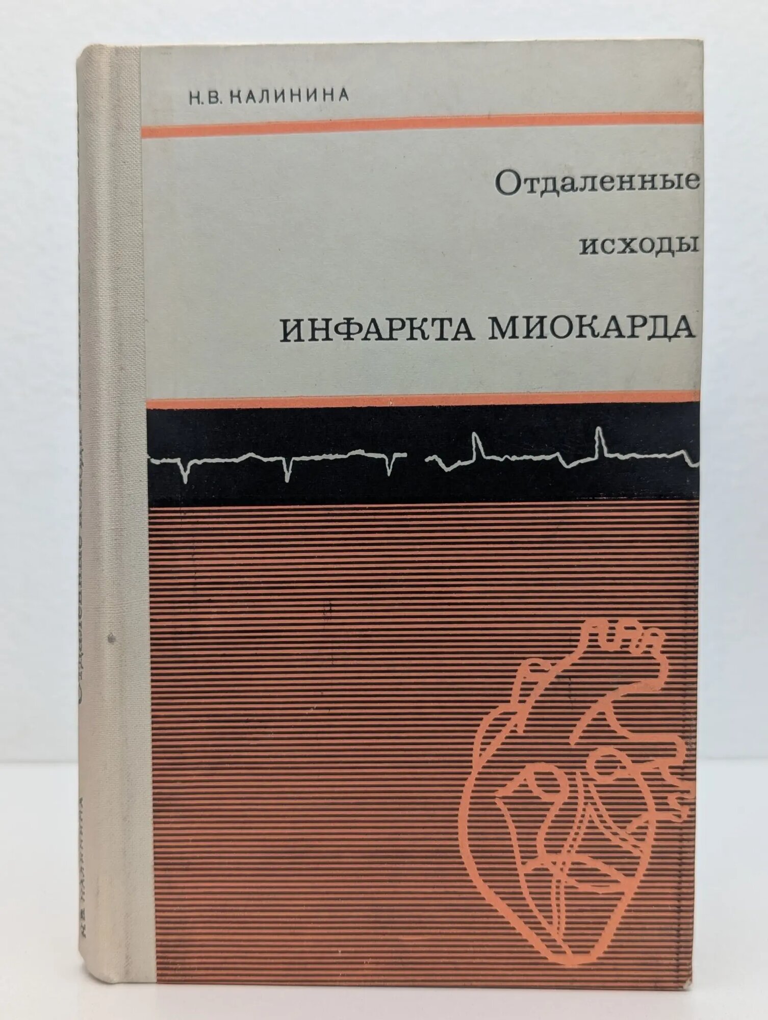 Отдаленные исходы инфаркта миокарда Калинина Нина Васильевна 1971