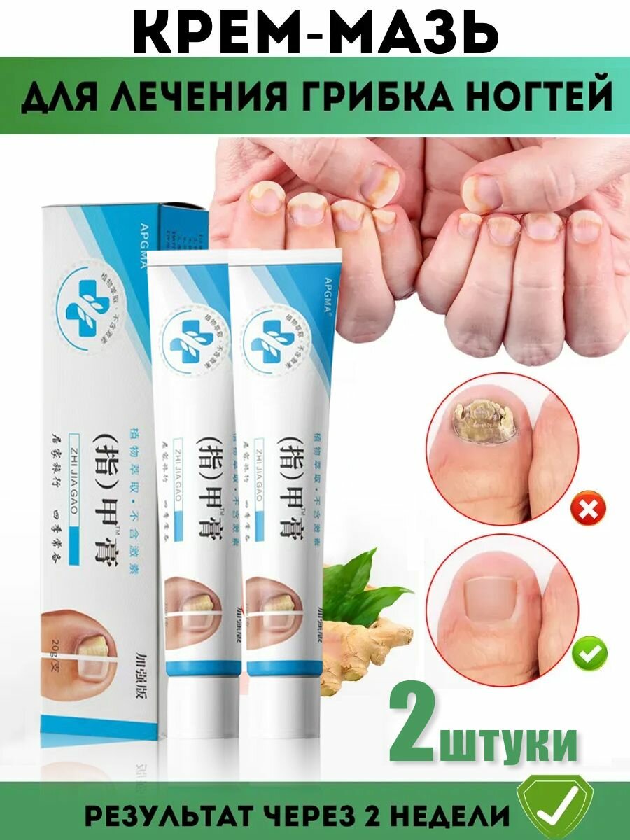 Сильная эссенция для лечения грибка ногтей, Отбеливание удаление грибка ногтей на ногах, 20мл
