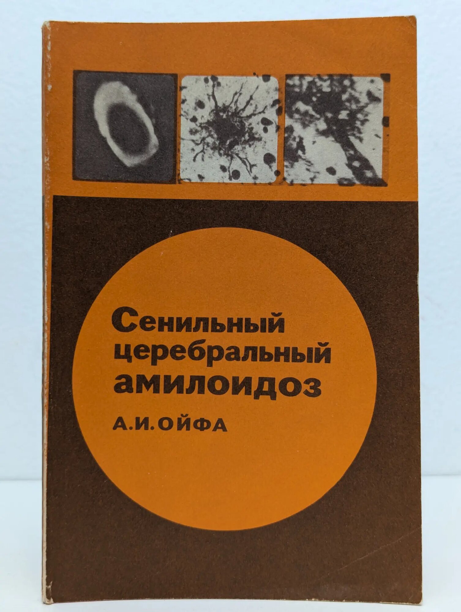 Сенильный церебральный амилоидоз Ойфа А. И. 1987