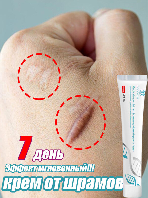 DODOYURI крем от шрамов и рубцов, Восстанавливающий рубцы, гиперплазия рубцов от ожогов, 20 г