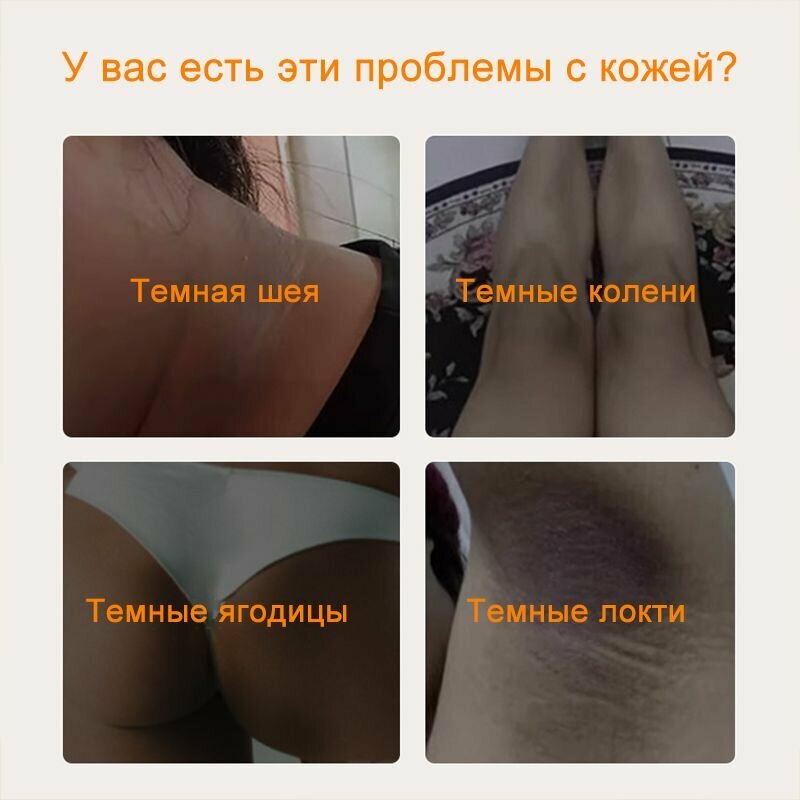 Отбеливающий крем для интимной зоны, тела, ягодиц, бикини, подмышек, коленей и локтей,60 г