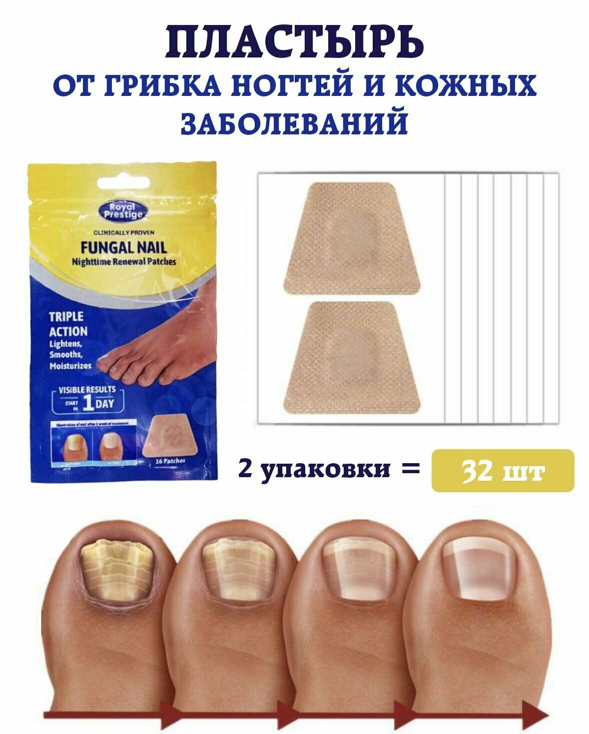 Пластырь от грибка ногтей и кожных заболеваний