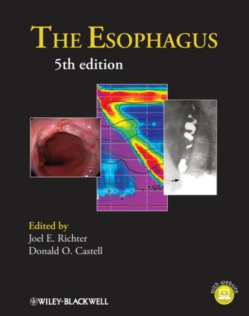Richter "The Esophagus, 5th Edition"