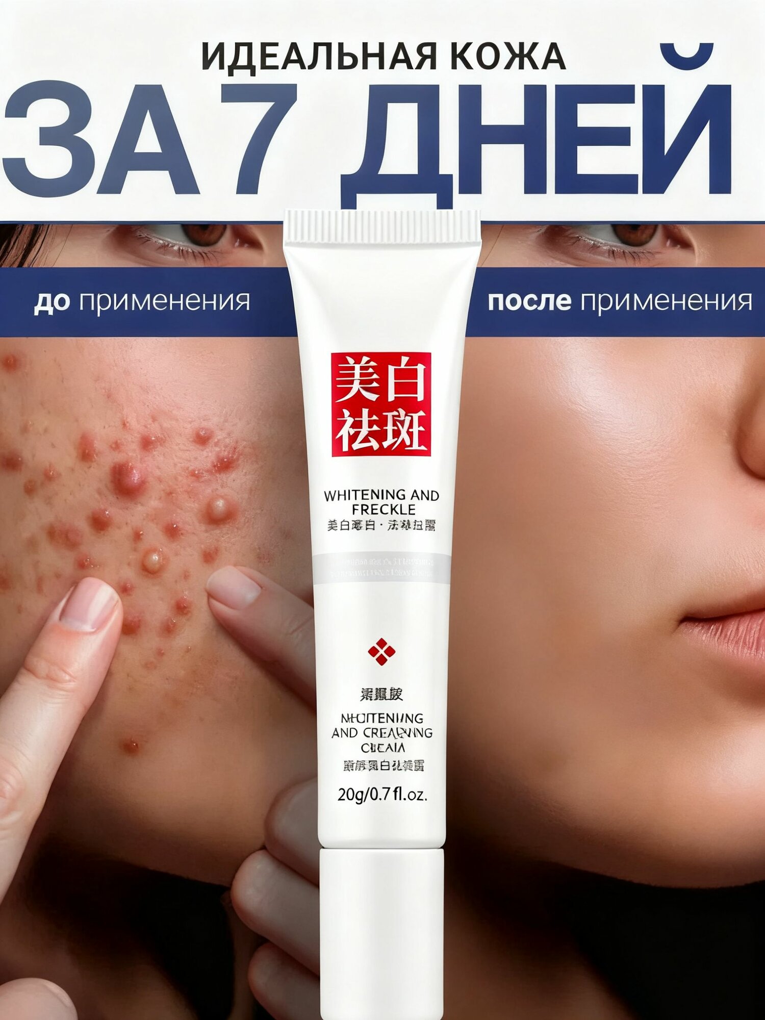 VOIS Крем для лица от воспалений с ниацинамидом, Точечный крем от прыщей, гель для лица от прыщей и черных точек точечный, корректирующий с ниацинамидом и цинком для проблемной кожи,20 г