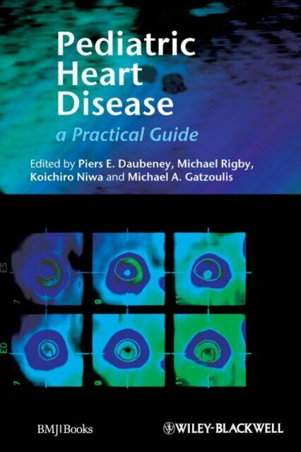 Daubeney "Perdiatric Heart Disease; a pract. Guide."