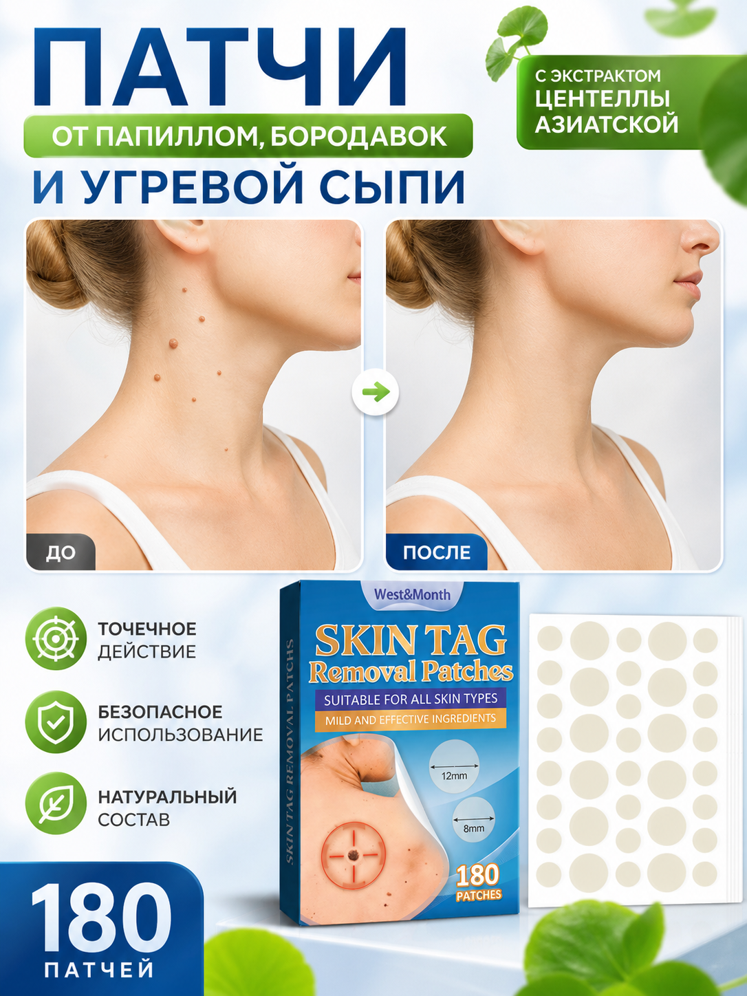 Пластырь от папиллом, бородавок и родинок, бактерицидный, угревой сыпи 180 штук
