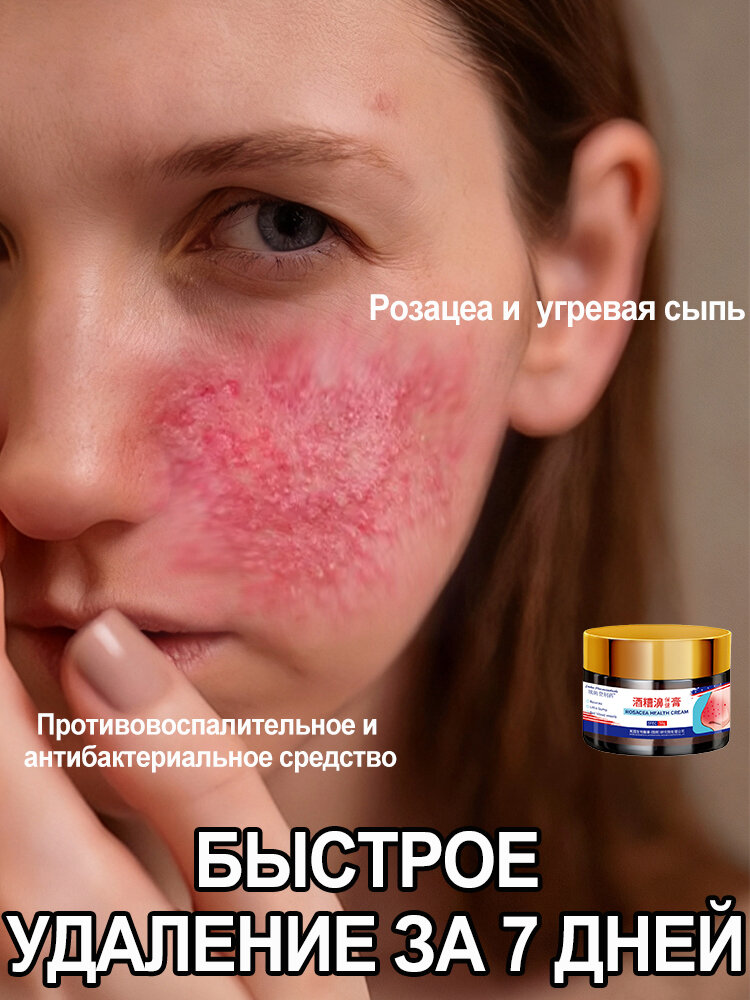 Крем для лица от купероза, розацеа, покраснений "Тонус-Капилляр Лица", 50 мл