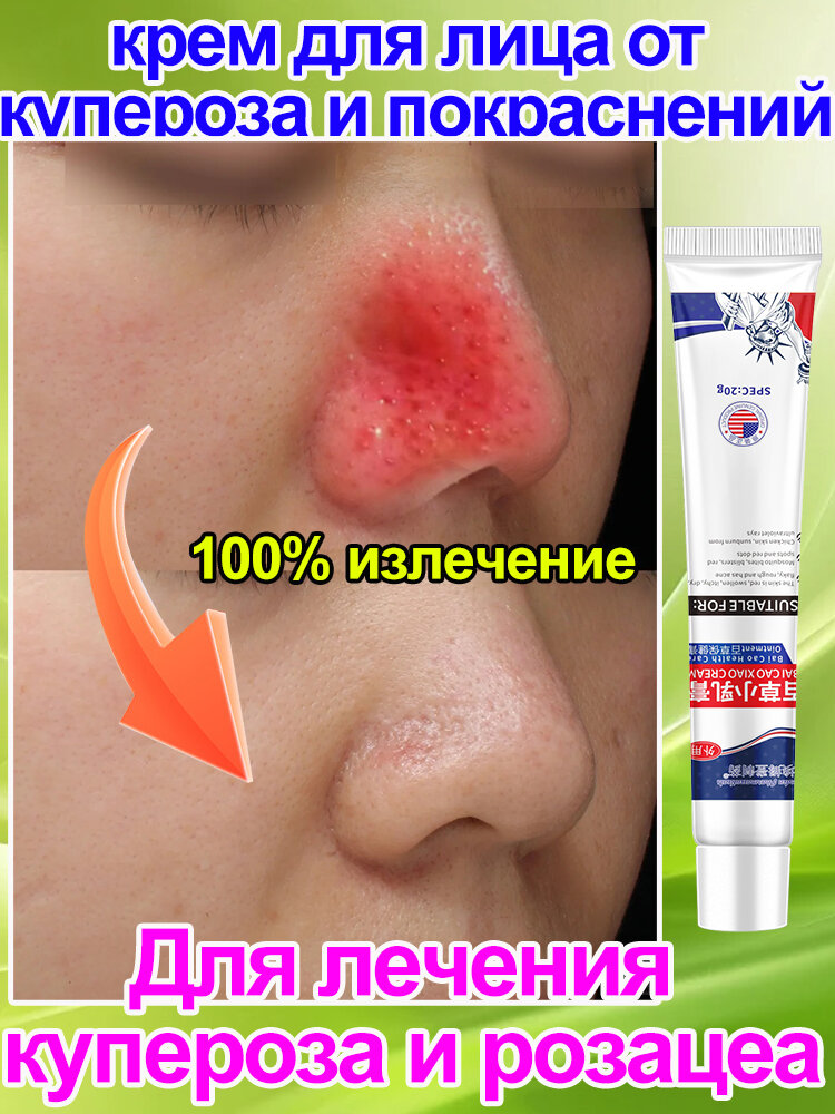 Лечит эритему лица и розацеа, успокаивает кожу, оказывает успокаивающее и противовоспалительное действие