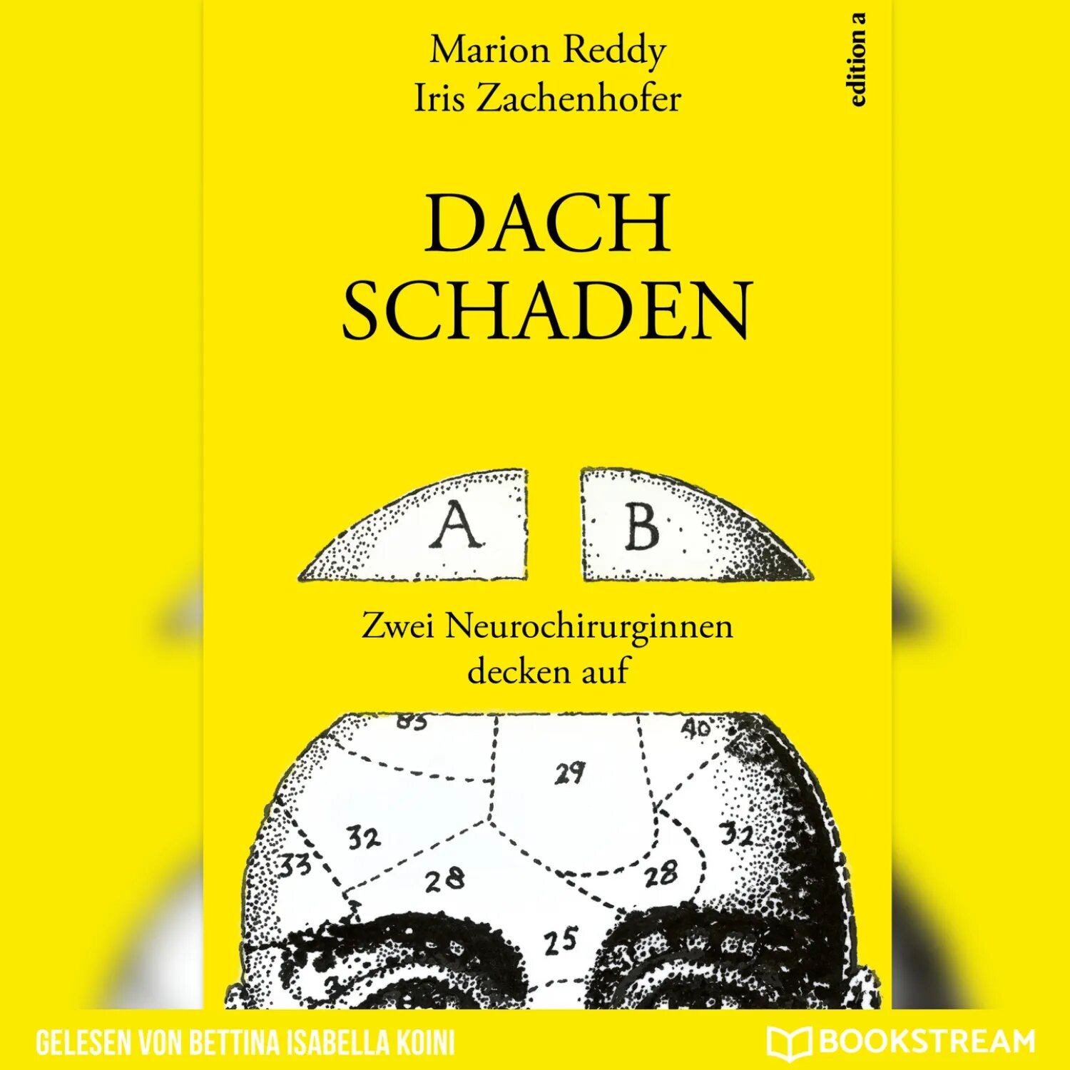 Dachschaden - Zwei Neurochirurginnen decken auf (Ungekürzt) [Аудиокнига]