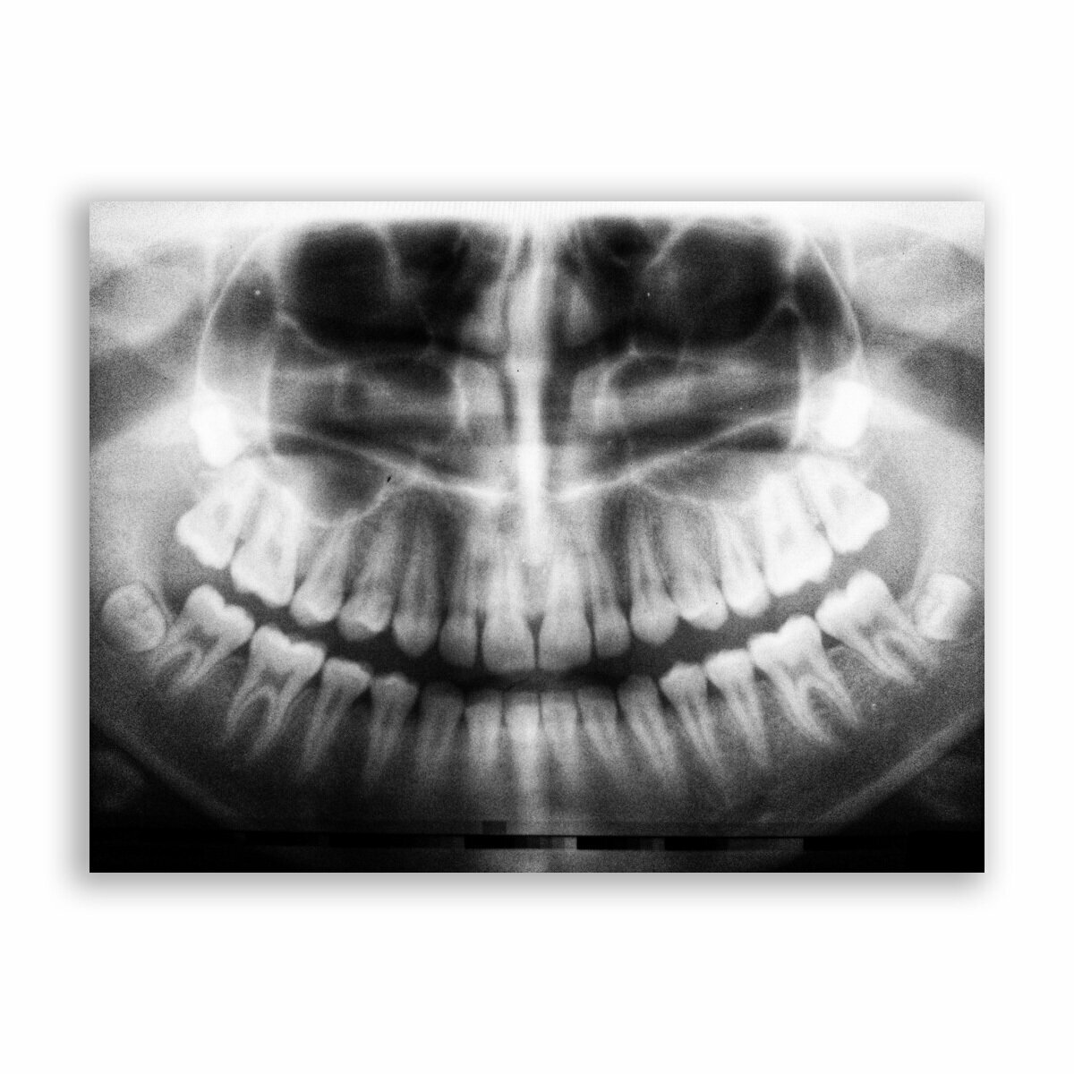 Постер, плакат на бумаге / Для стоматологии / Размер 60 x 80 см