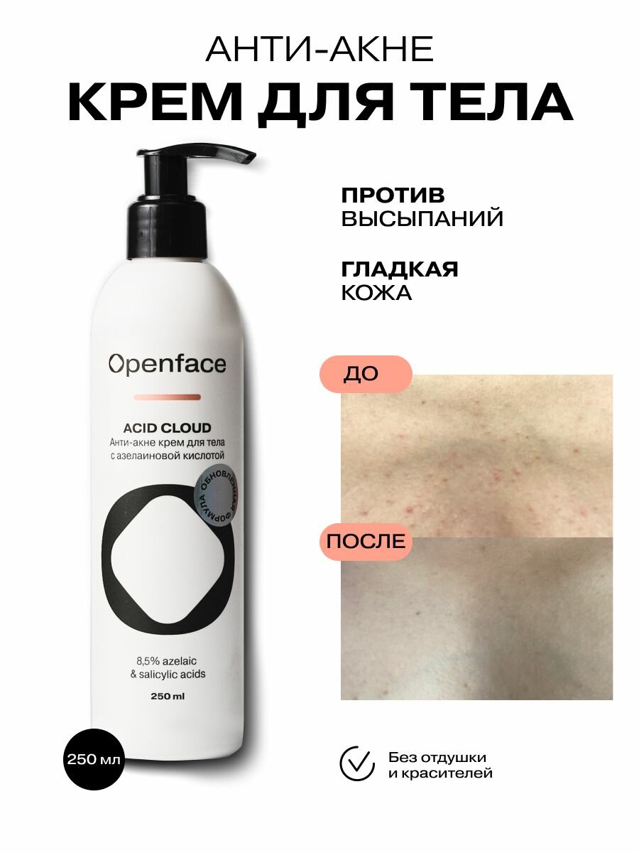 Анти-акне крем для тела с азелаиновой кислотой Acid Cloud
