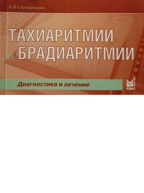 Тахиаритмии и брадиаритмии: диагностика и лечение.