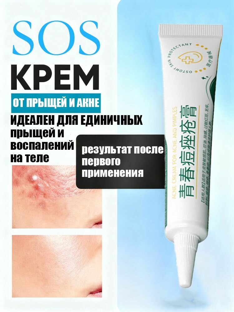 Крем от прыщей точечный/против прыщей, от акне комедонов угрей черных точек, средство для подростков, для проблемной кожи,20 мл,1шт