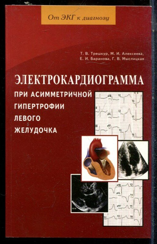 Трешкур Т.В., Алексеева М.И., Баранова Е.И. - Электрокардиограмма при асимметричной гипертрофии левого желудочка - 2009