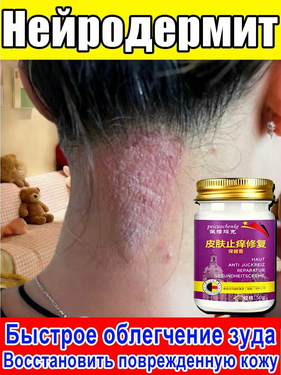 Мазь от нейродермита и дерматита