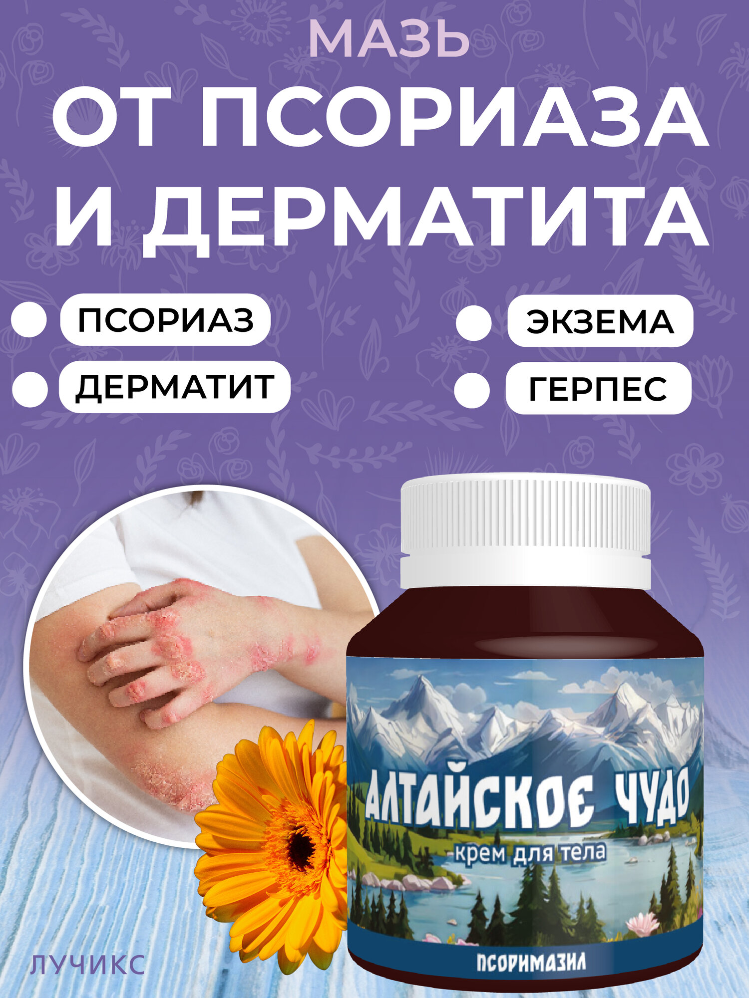 Алтайская чудо мазь от кожных заболеваний, крем от дерматита, экземы, негормональный крем "Псоримазил". 90мл /лучикс