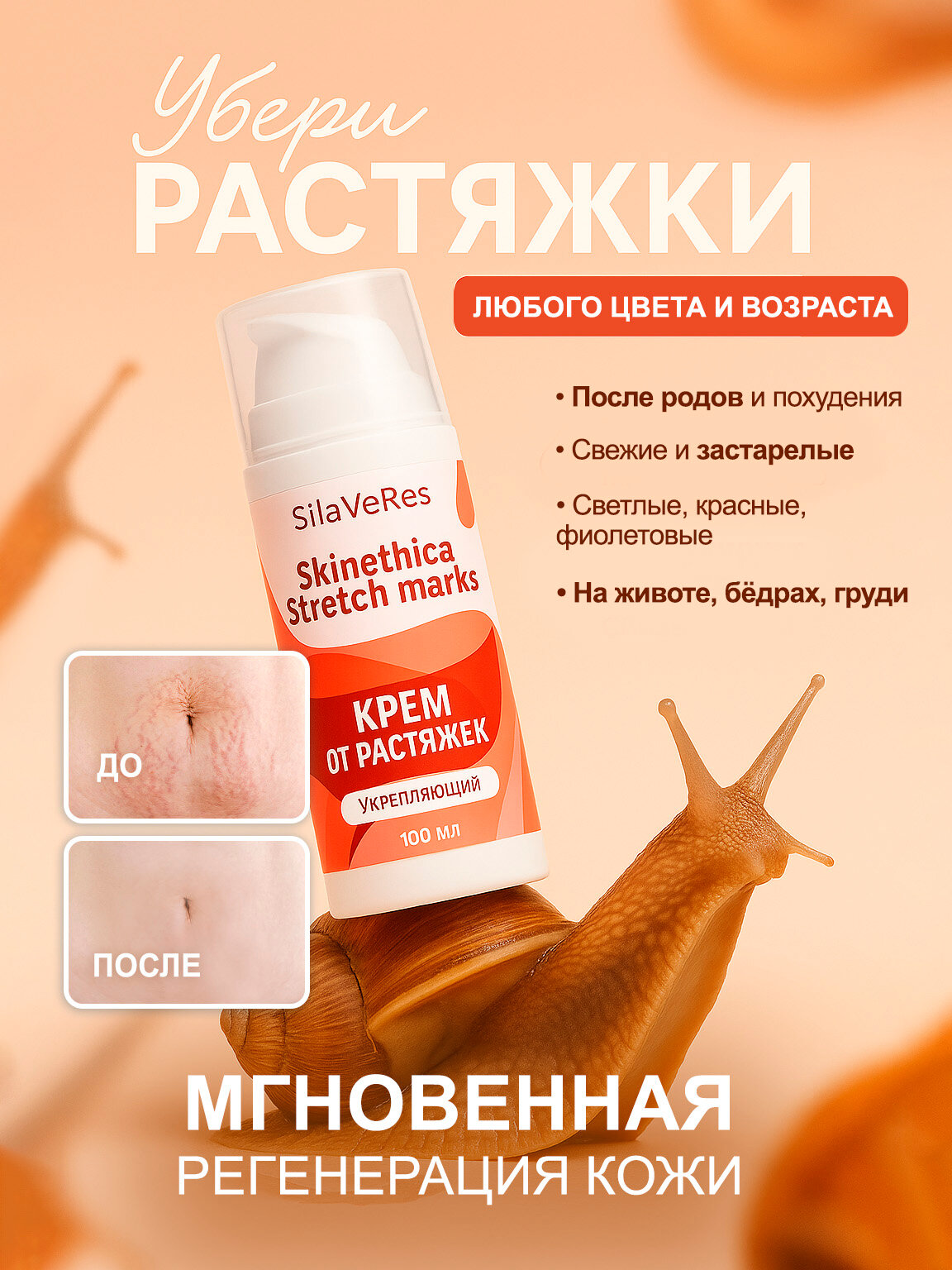 Крем от растяжек, регенерирующий, 100 мл, SilaVeres