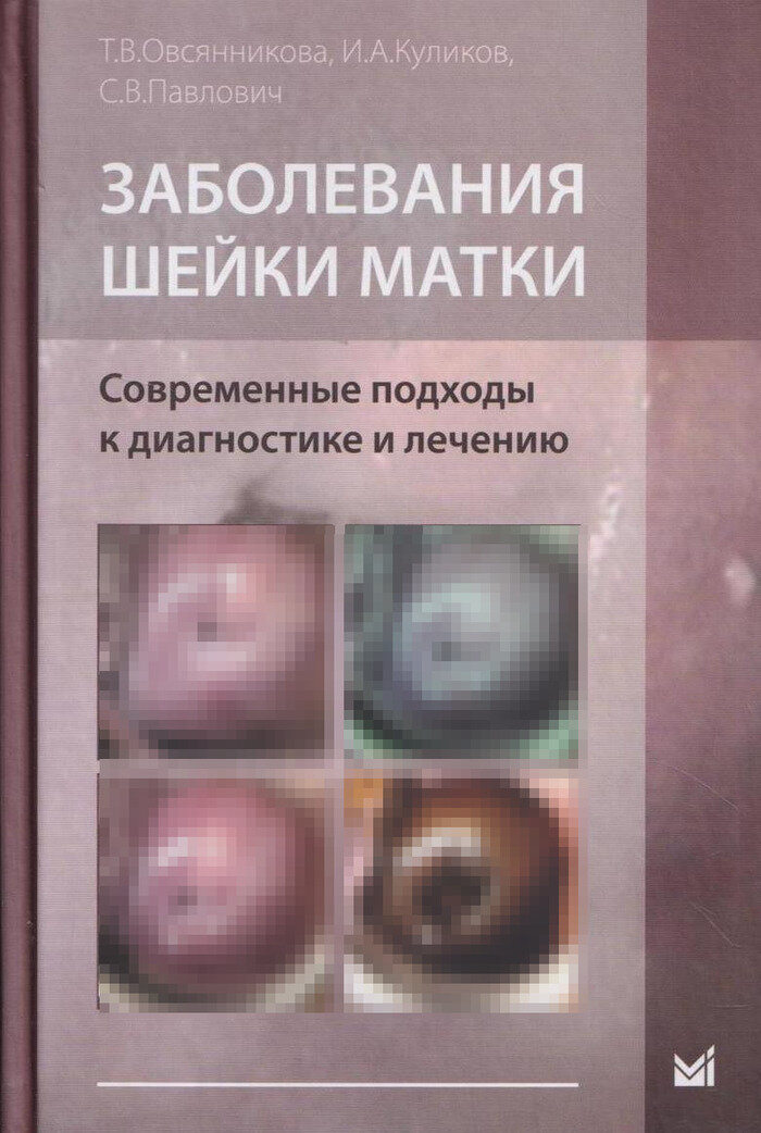 Заболевания шейки матки. Современные подходы к диагностике и лечению