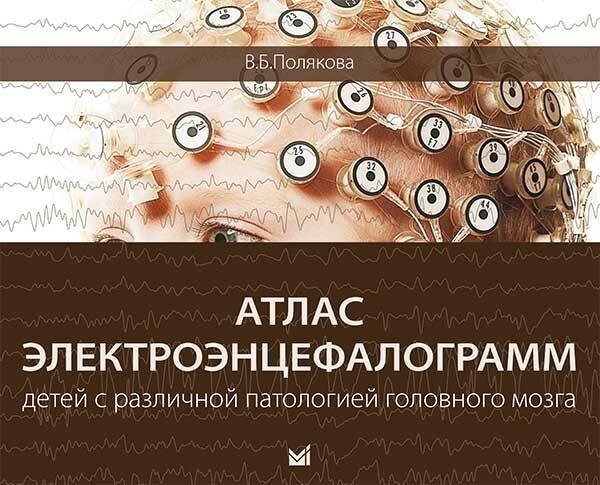 Атлас электроэнцефалограмм детей с различной патологией головного мозга