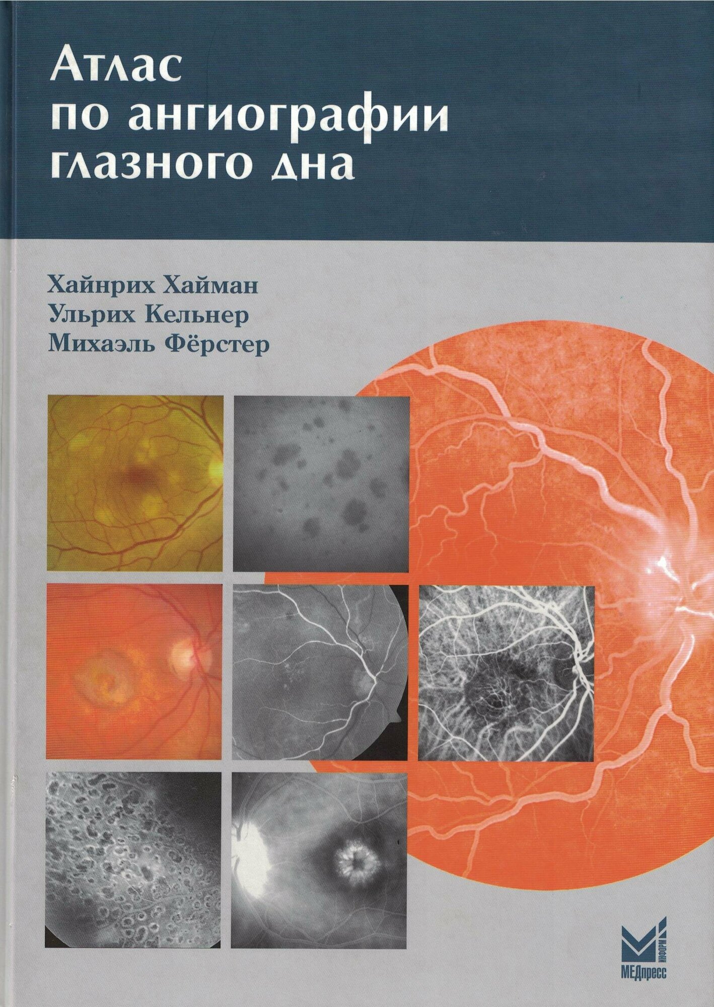 Атлас по ангиографии глазного дна