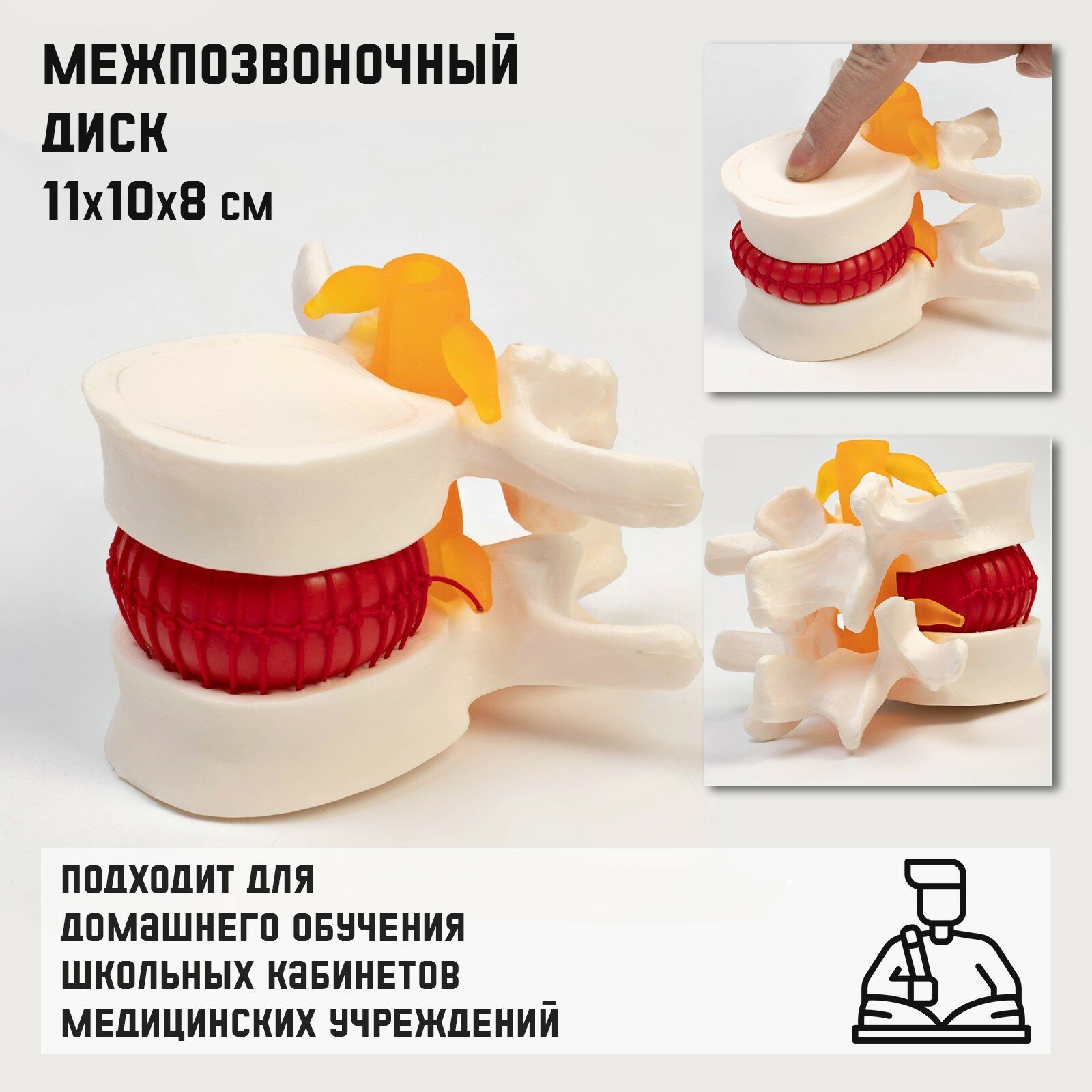 Анатомическая модель «Макет межпозвонкового диска», 11×10×8 см