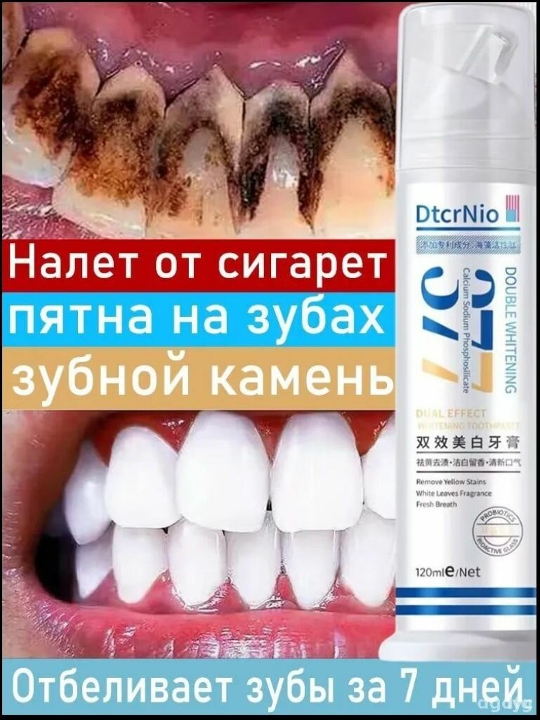 Эксклюзивная паста для чувствительных зубов 120 г, обеспечивающая мощное отбеливание, эффективно устраняющая зубной камень, налет от кофе и сигарет, а также борющаяся с неприятным запахом изо рта