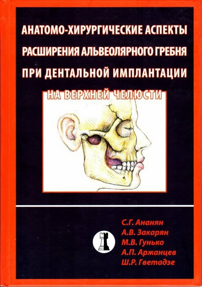 Анатомо-хирургические аспекты расширения альвеолярного гребня при дентальной имплантации на верхней челюсти