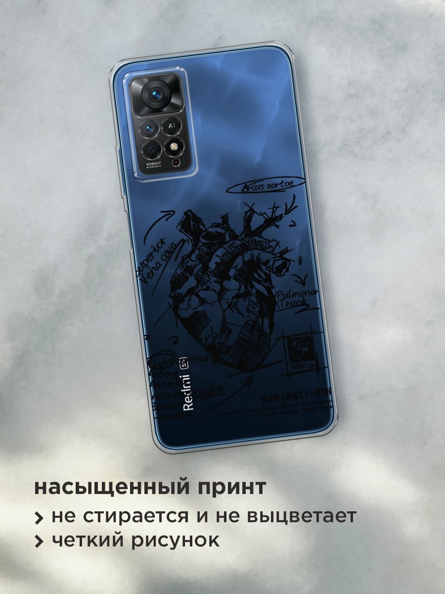 Чехол на Xiaomi Redmi Note 11E Pro / Сяоми Редми Нот 11E Pro Про с принтом "Анатомическое сердце 2", прозрачный — фото 1