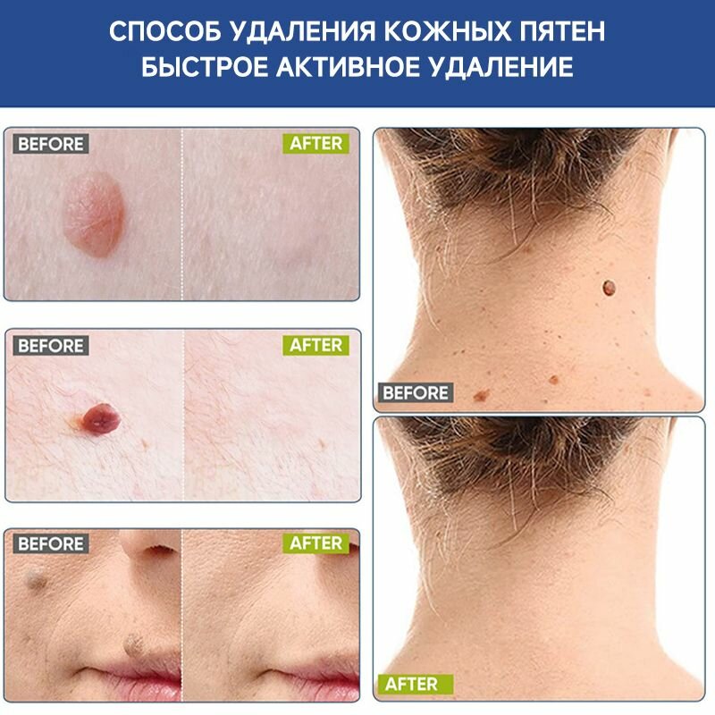 Лечебное средство — фото 1